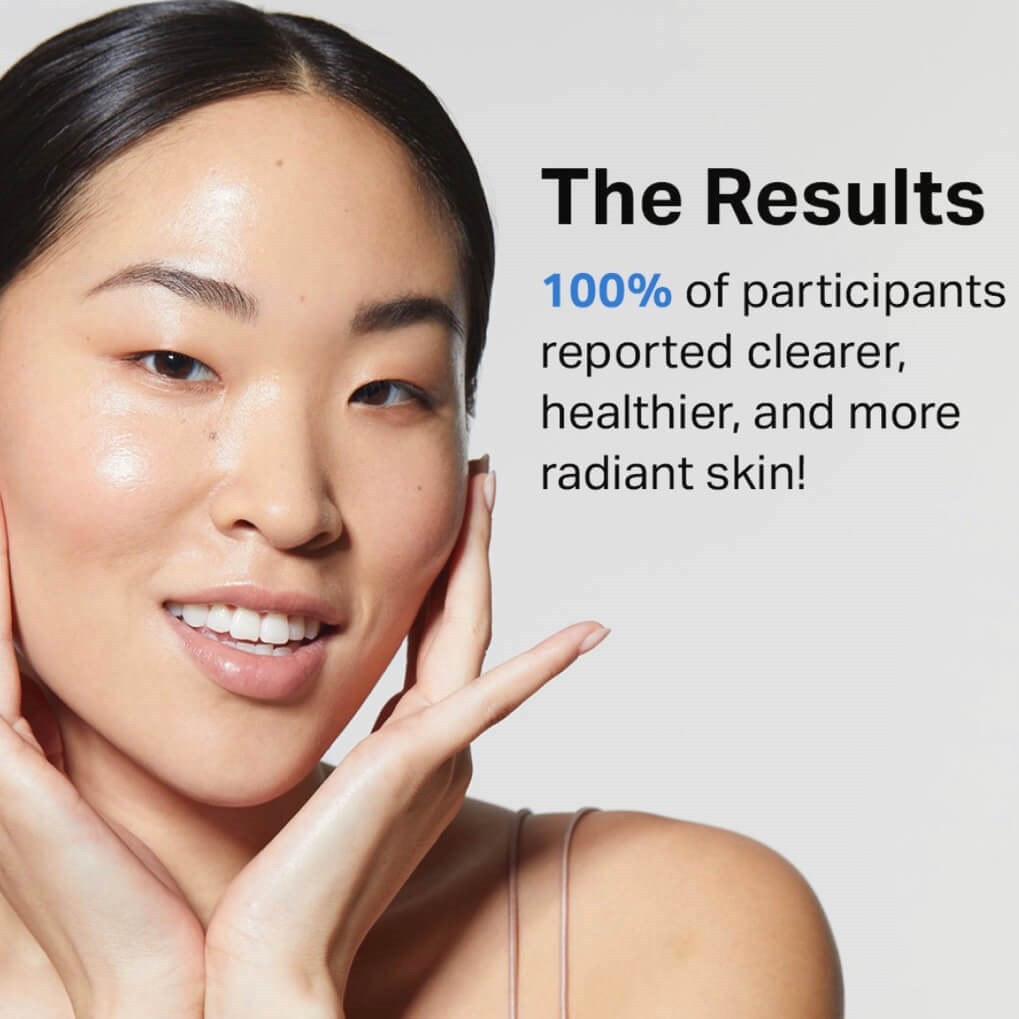 Hydrafacial treatments improve acne