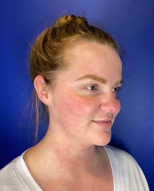 Best MedSpa in Dallas | Premier Medical Spa | ZO Skin Centre